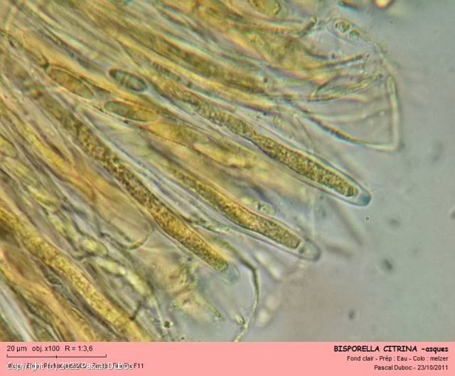 MycoDB : Photos de champignons - Bisporella citrina
