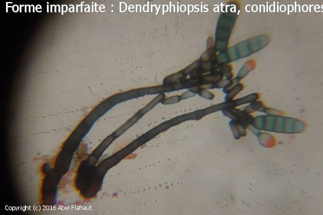 MycoDB : Photos de champignons - Kirschsteiniothelia atra