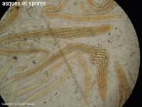 MycoDB : Fiche de Gaeumannomyces graminis